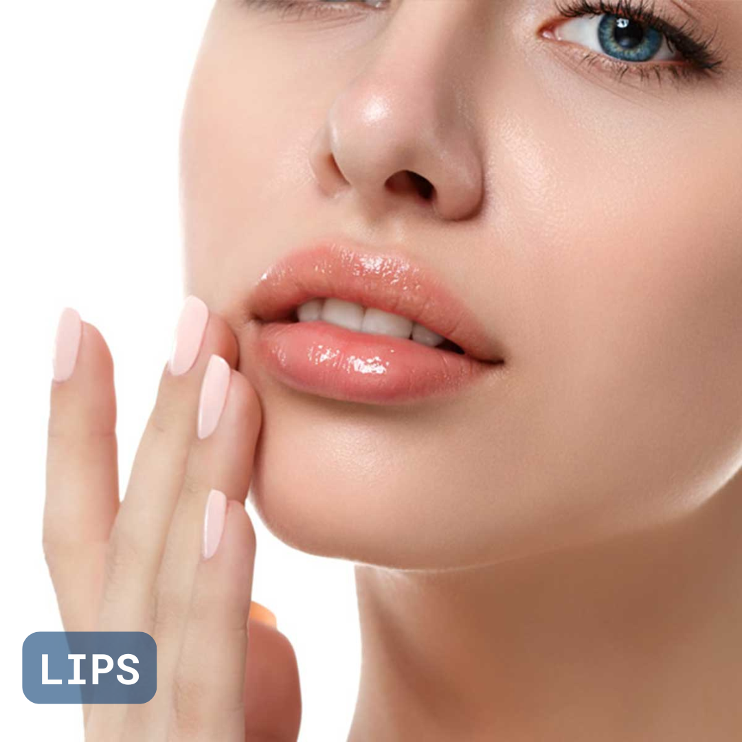 INJECTABLE FILLERS | Slate Medspa